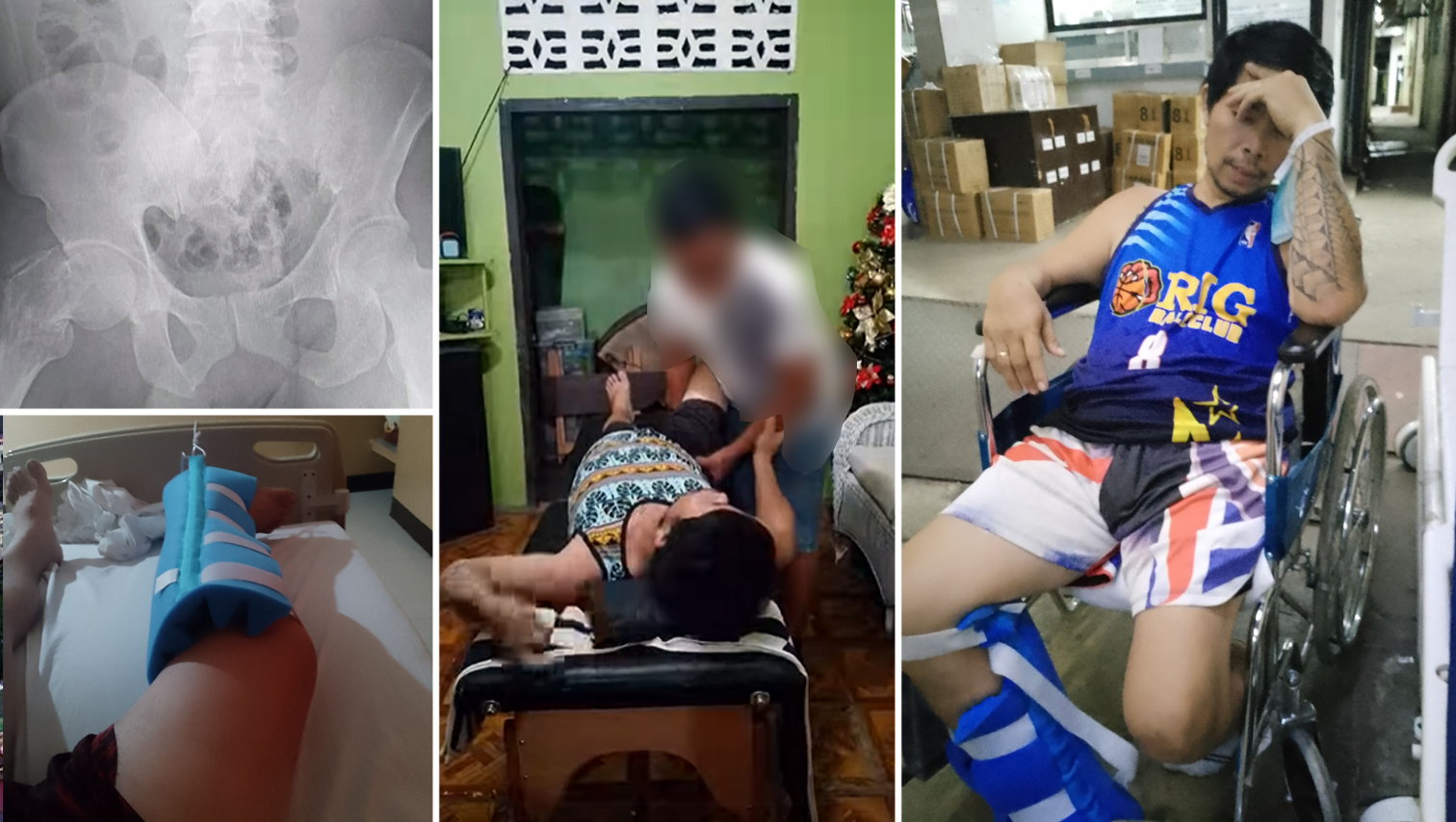 VIDEO WATCH: From chiropractor to 'chirofracture'- man suffers bone fracture after 'hilot ...